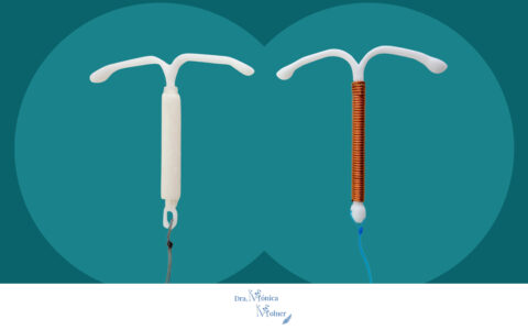 DIU hormonal o de cobre, te aclaro las diferencias